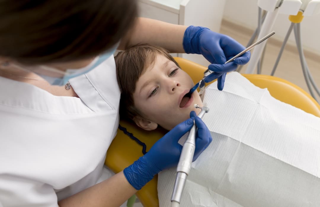 Pediatric Dental Fillings - عيادات بايولايف